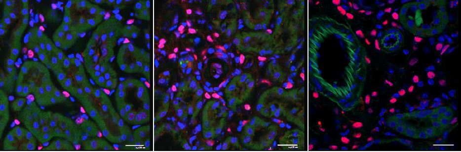 Meis1 in Kidney Aging and Injury - Unexpected Findings - Division of ...