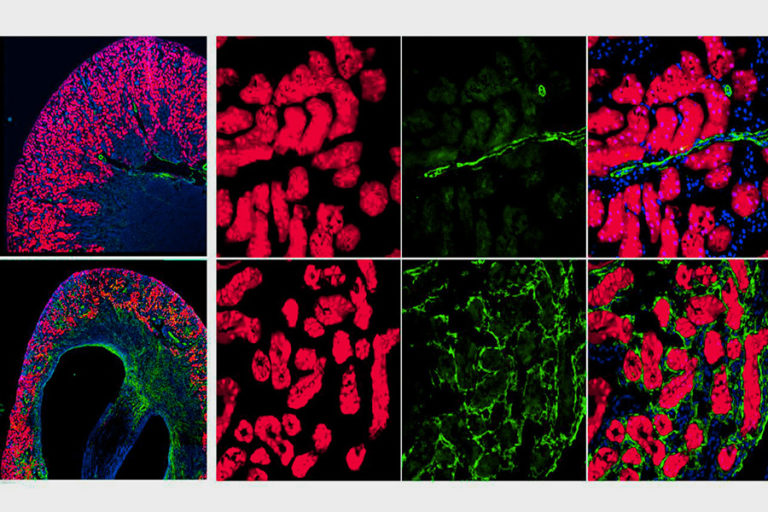 Study Details Origin of Myofibroblasts Responsible for Kidney Fibrosis ...